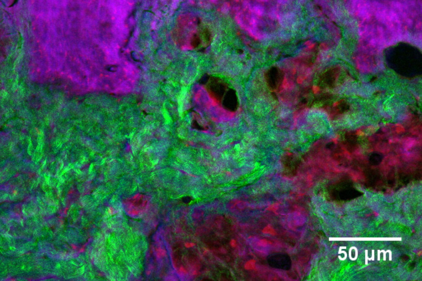 Formulated Product Characterization with SRS Microscopy | Learn & Share ...
