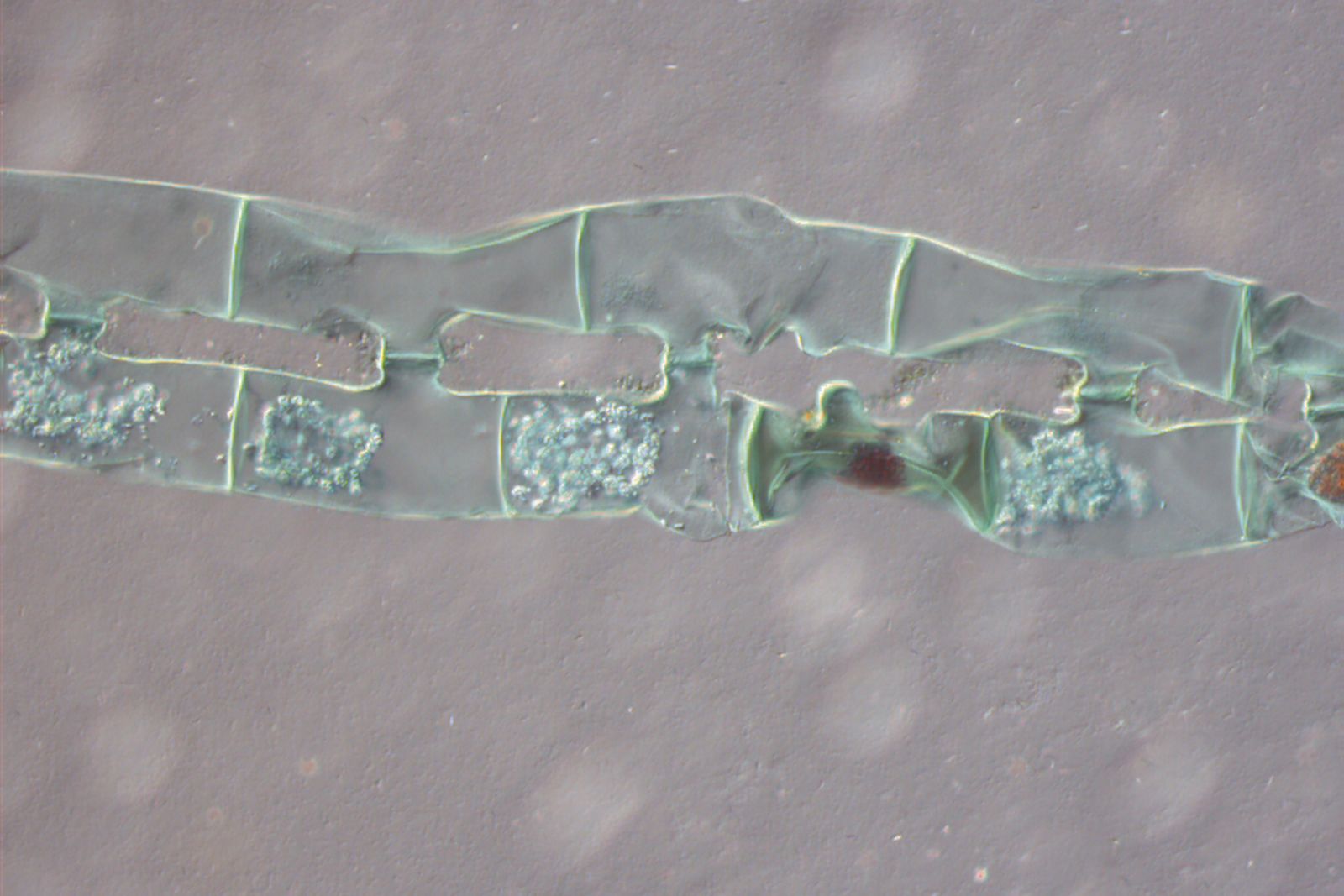 Differential Interference Contrast (DIC) Microscopy | Learn & Share ...