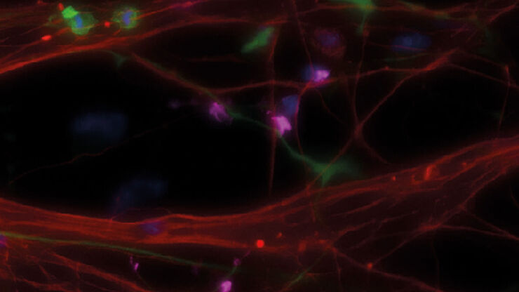 Leica DM3000 & DM3000 LED Uniquely Ergonomic System Microscopes With ...