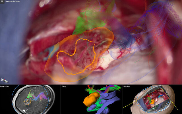 Evolved ARveo 8 Digital Visualization Microscope for Neurosurgery ...