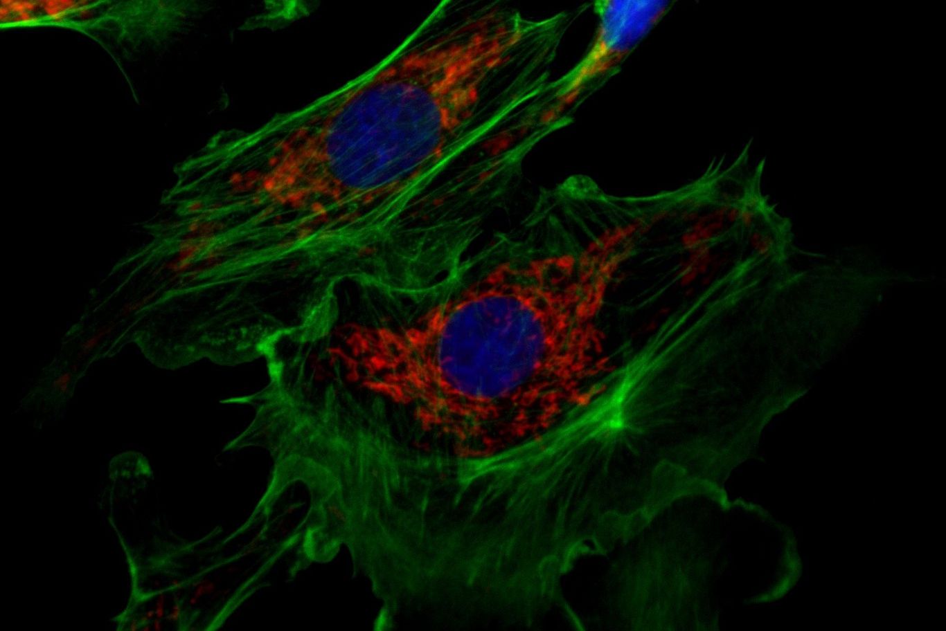 Technical Terms for Digital Microscope Cameras and Image Analysis ...