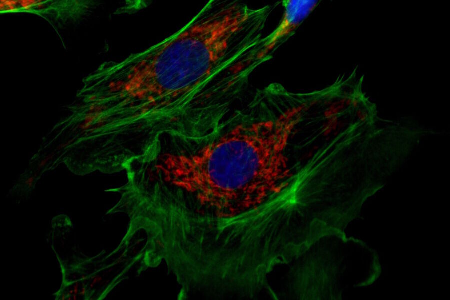 Technical Terms for Digital Microscope Cameras and Image Analysis ...