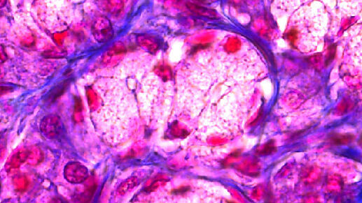 Anatomic Pathology | Applications | Leica Microsystems