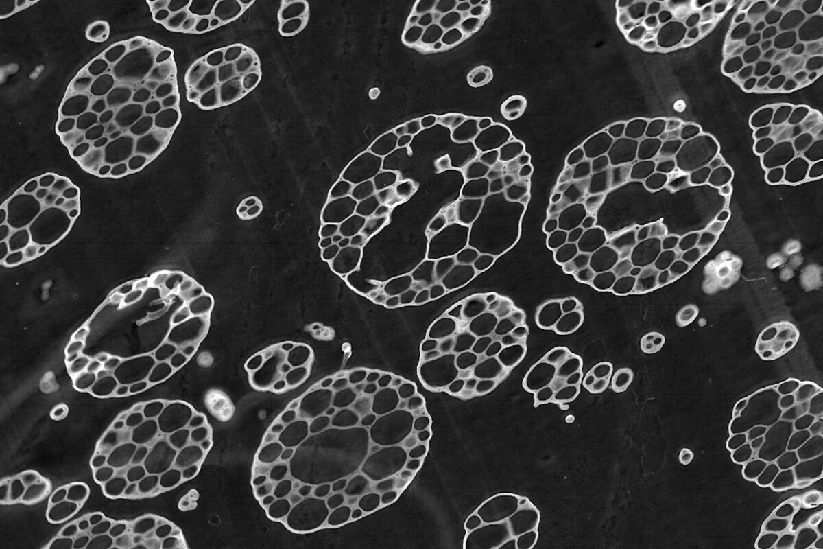 battlement technique microscope