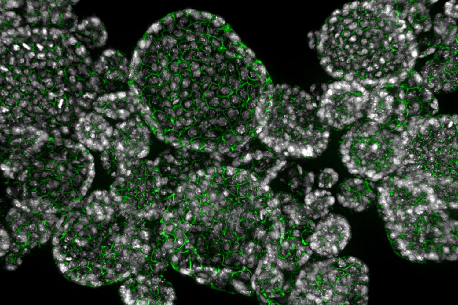 THUNDER Imager 3D Cell Culture | Products | Leica Microsystems