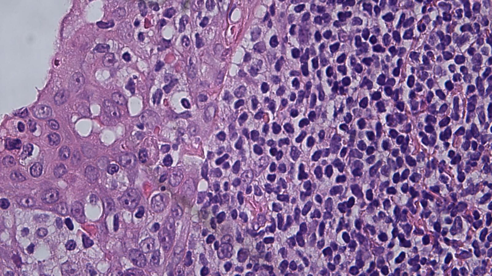 Anatomic Pathology | Applications | Leica Microsystems