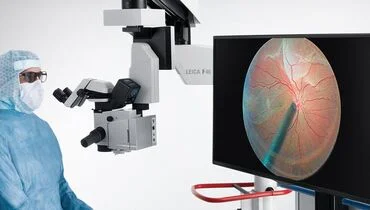 Ophthalmology | Applications | Leica Microsystems