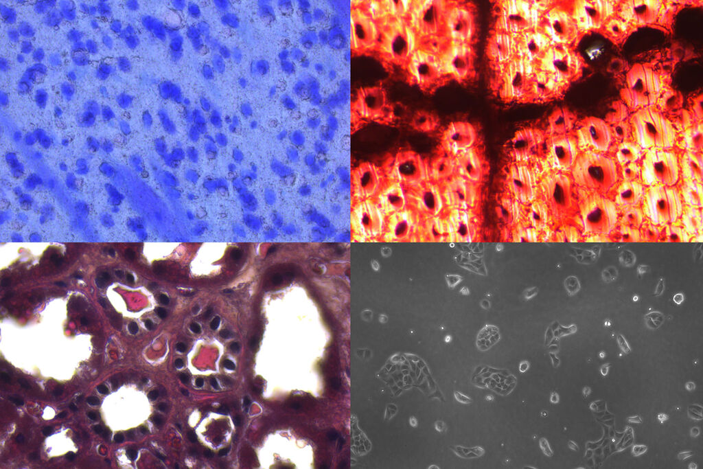 Leica LMD6 & LMD7 Laser Microdissection Microscopes | Products | Leica ...