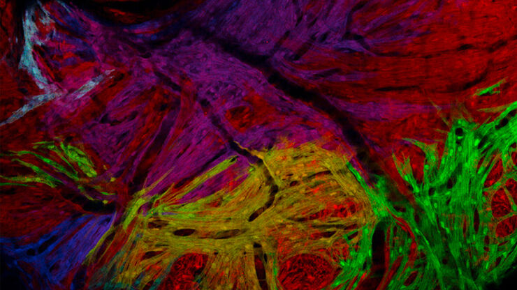 Microscopes and Imaging Systems | Leica Microsystems