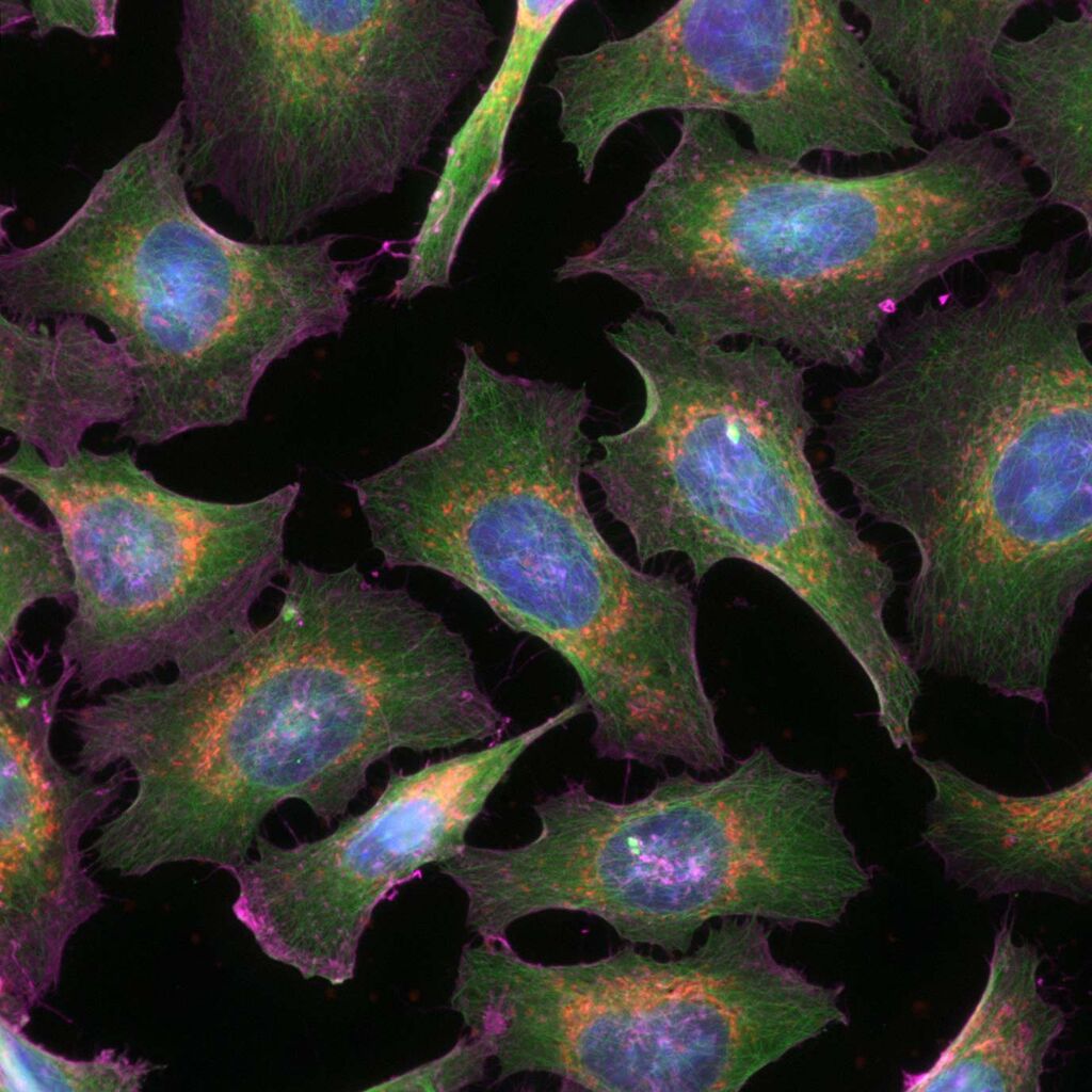 K5 sCMOS Microscope Camera | Products | Leica Microsystems