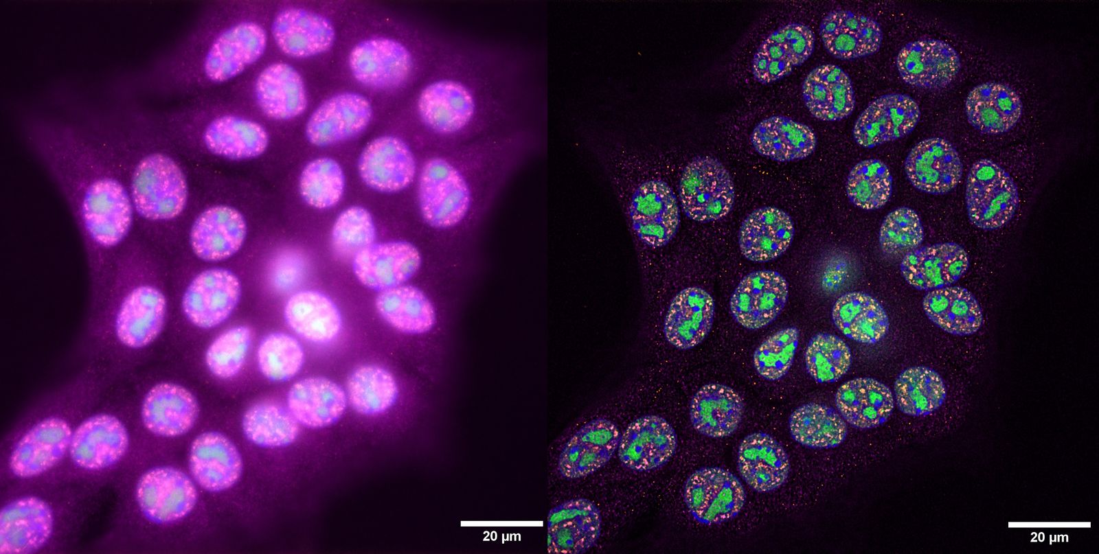 Micron Bioimaging Facility at the University of Oxford | Learn & Share | Leica Microsystems