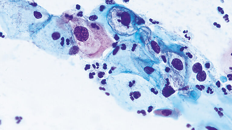 Microscopy in Pathology | Applications | Leica Microsystems