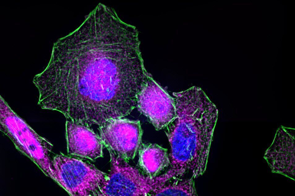 Chronic Inflammation Under the Microscope | Learn & Share | Leica ...