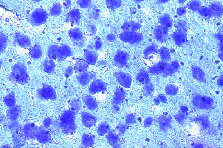 Leica LMD6 & LMD7 Laser Microdissection Microscopes | Products | Leica ...