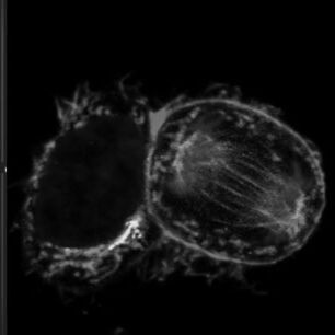 Confocal reimagined - STELLARIS - EMEA | Leica Microsystems