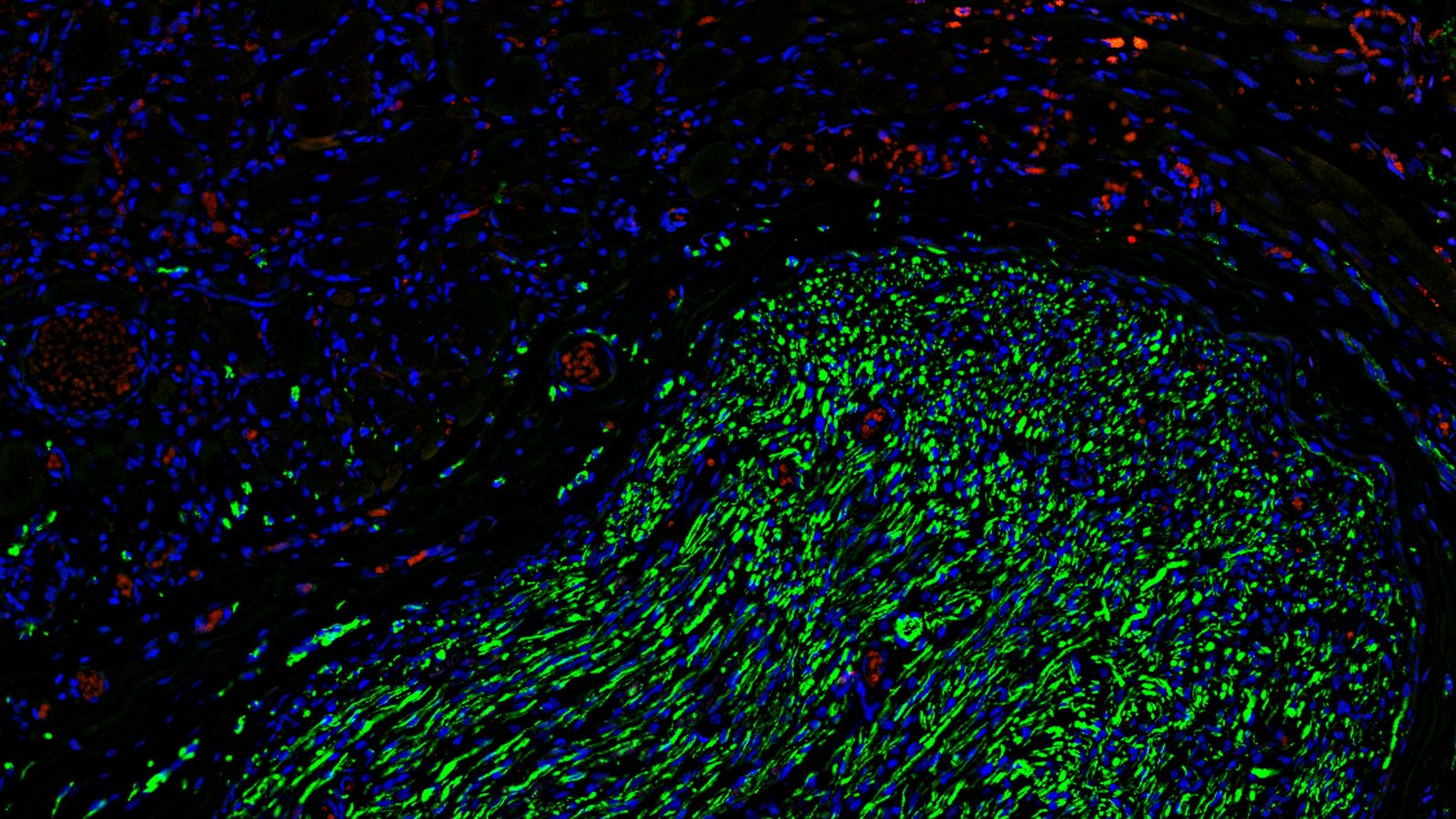 How to Image Axon Regeneration in Deep Muscle Tissue | Learn & Share ...