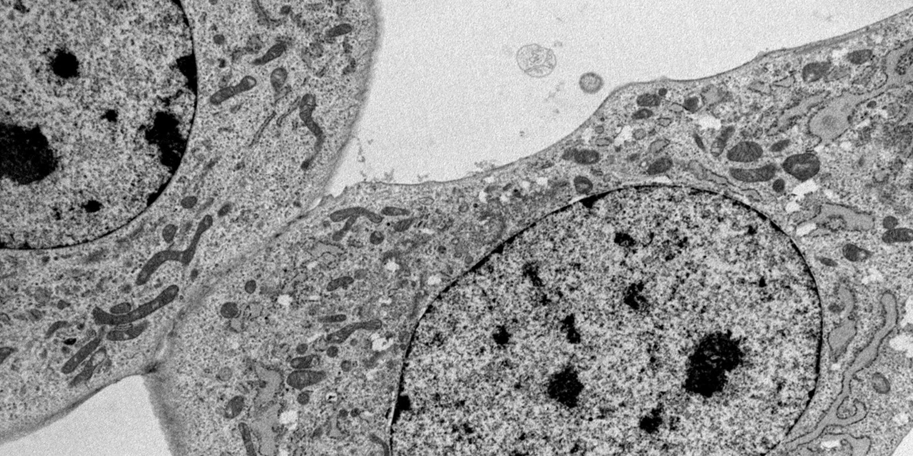 Leica EM TP Electron Microscope Tissue Processing | Products | Leica ...