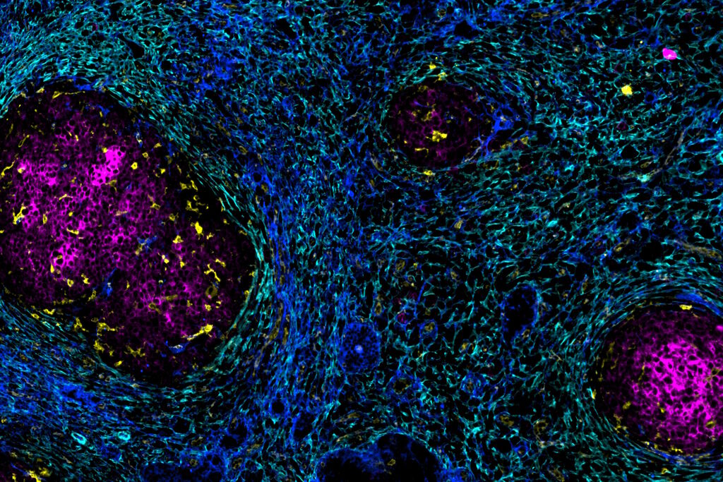 Accelerating Discovery for Multiplexed Imaging of Diverse Tissues ...