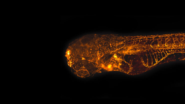 Confocal Microscopes | Products | Leica Microsystems