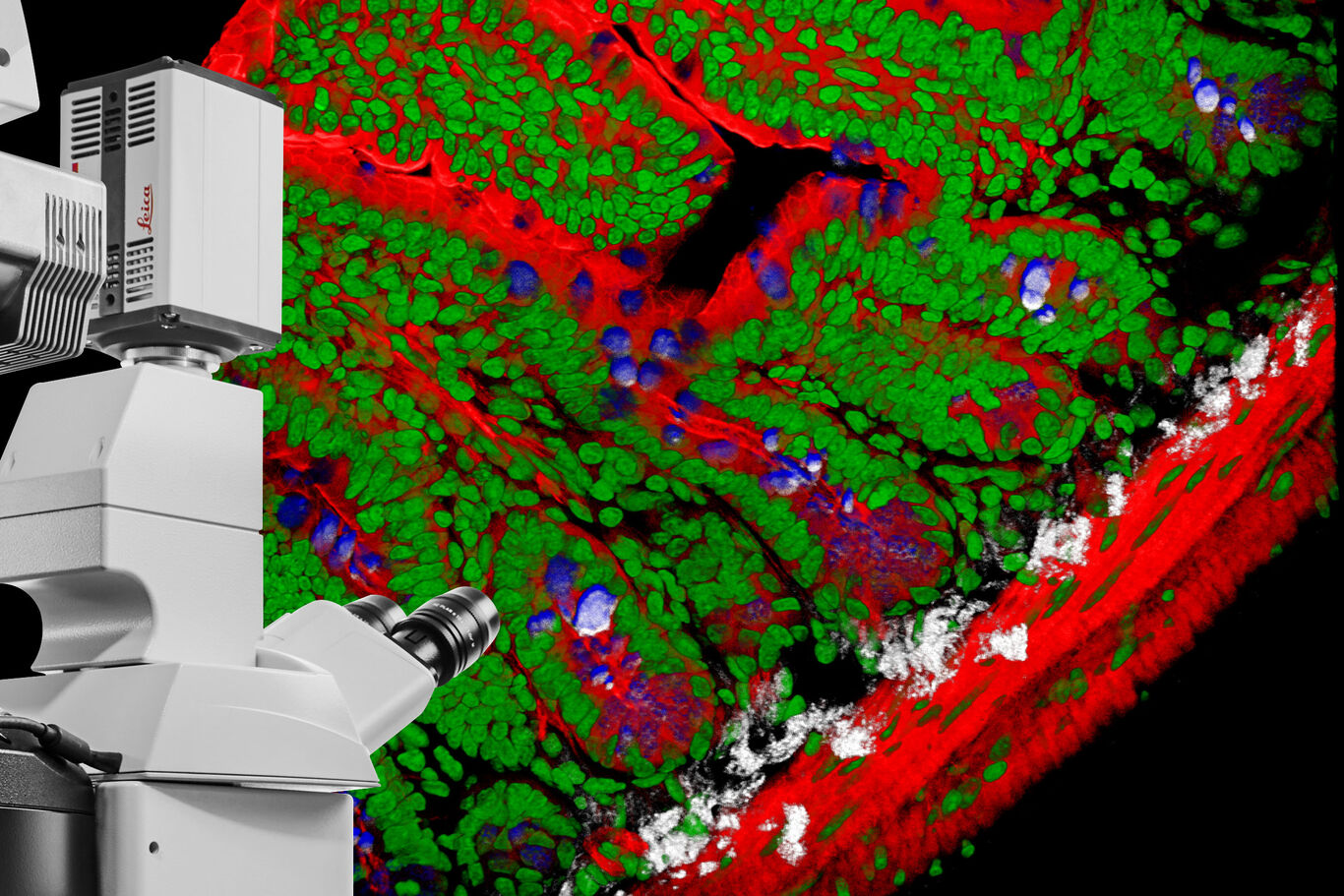 DIVE Multiphoton Microscope Image Gallery | Learn & Share | Leica Microsystems