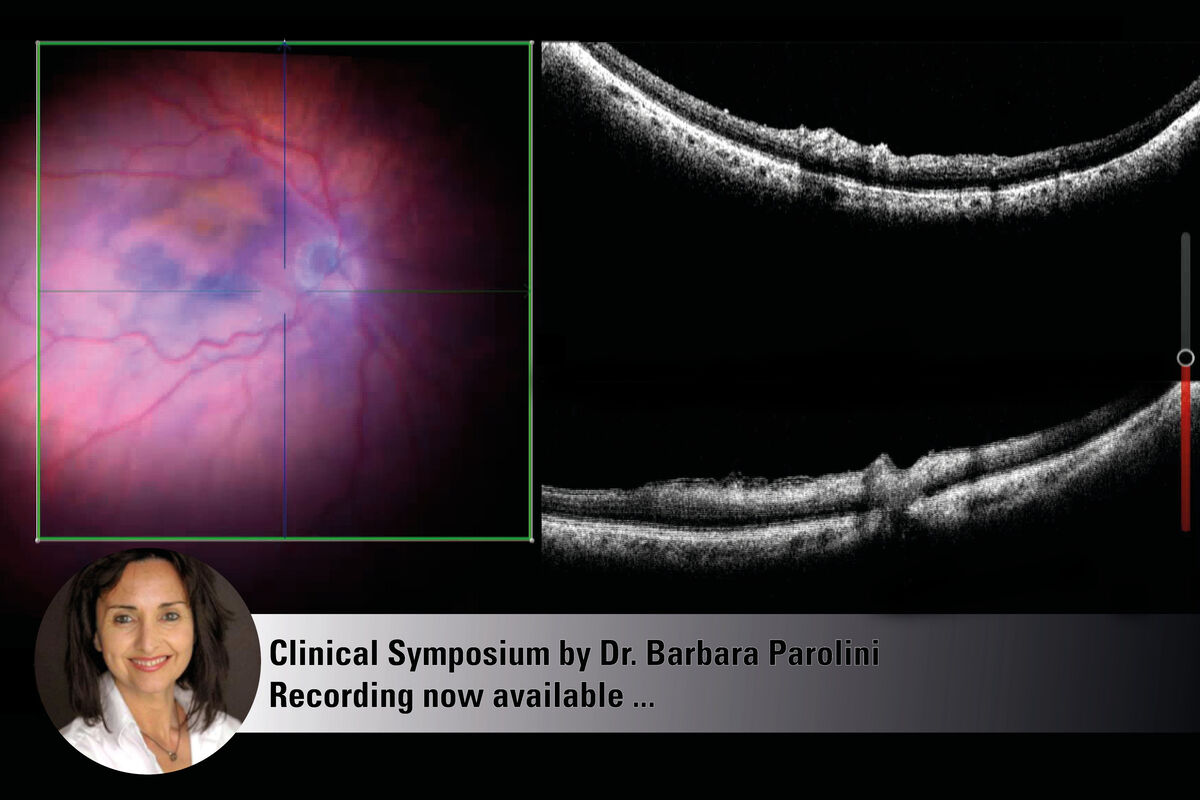 How OCT-guided Eye Surgery can help you to Focus on Perfection | Learn ...