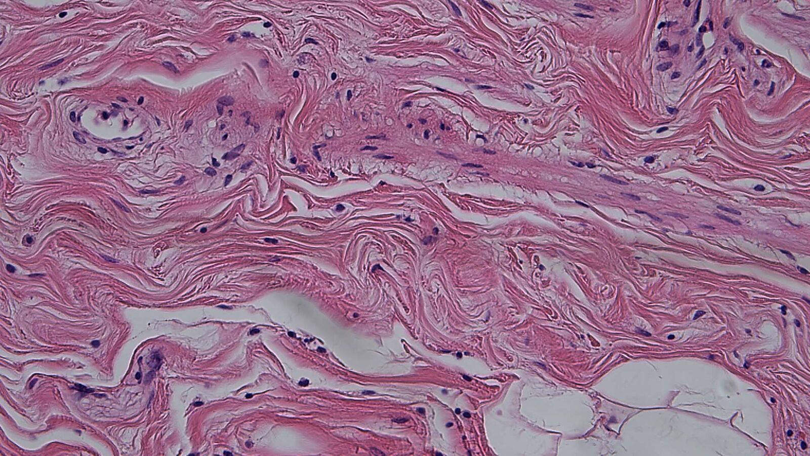 Microscopy in Pathology | Applications | Leica Microsystems