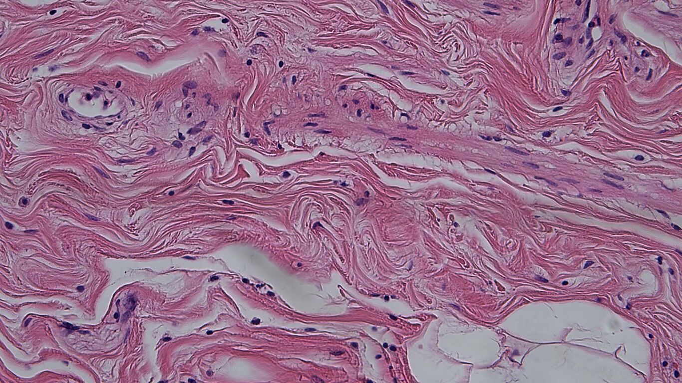 Clinical Pathology | Applications | Leica Microsystems