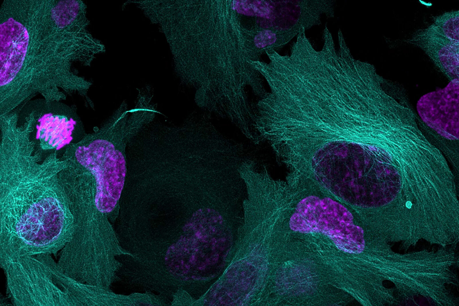 Considerations for Multiplex Live Cell Imaging | Learn & Share | Leica ...