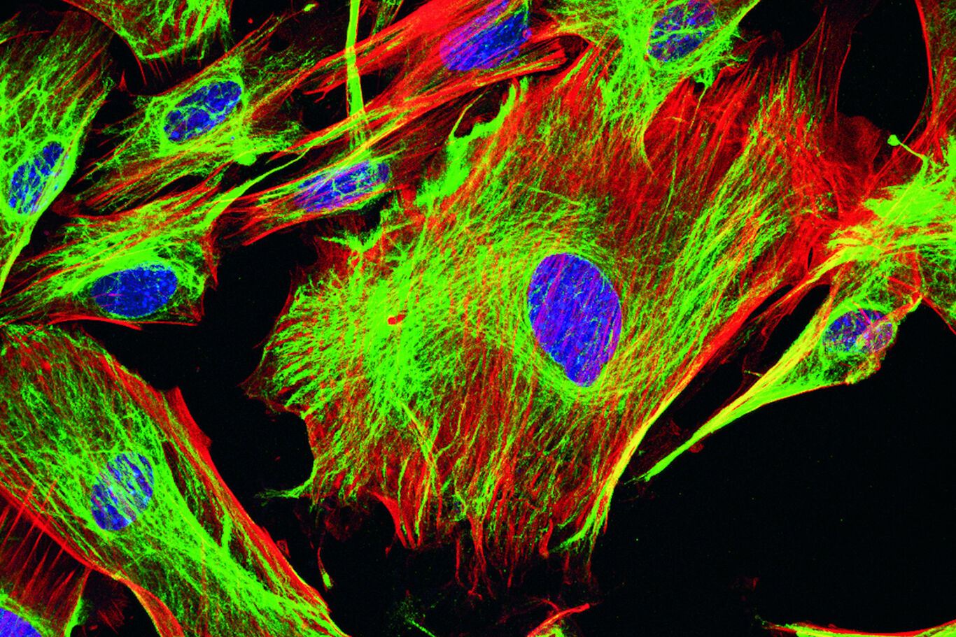 Fluorescent Dyes | Learn & Share | Leica Microsystems