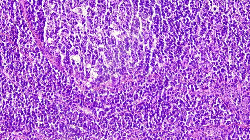 Anatomic Pathology | Applications | Leica Microsystems