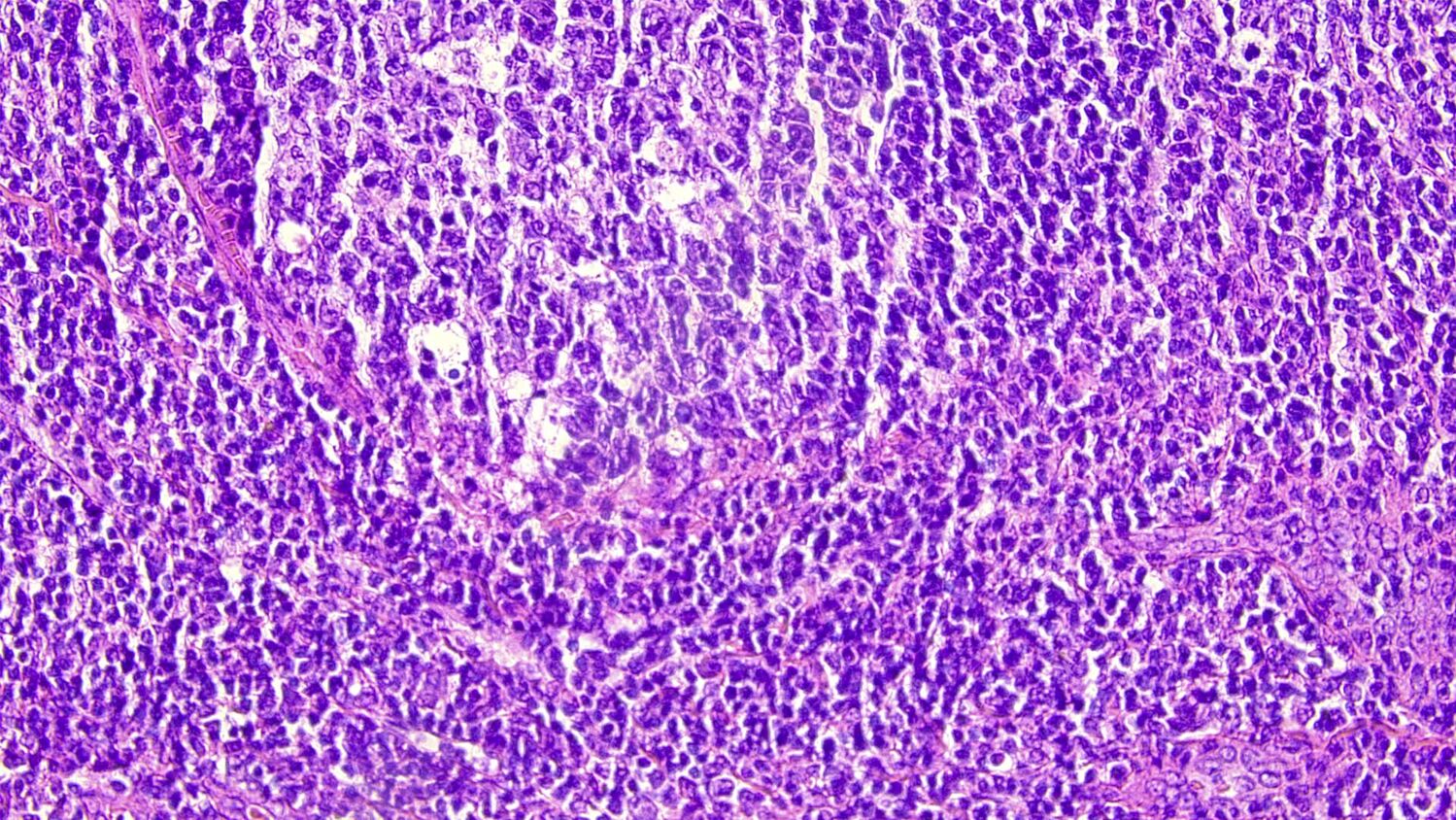 Anatomic Pathology | Applications | Leica Microsystems