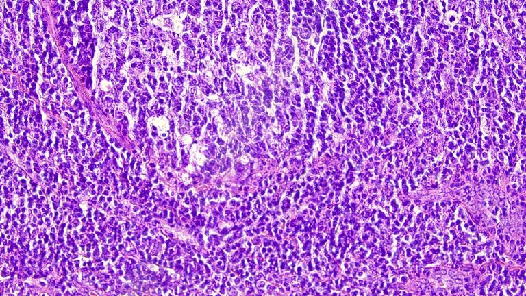 Anatomic Pathology | Applications | Leica Microsystems