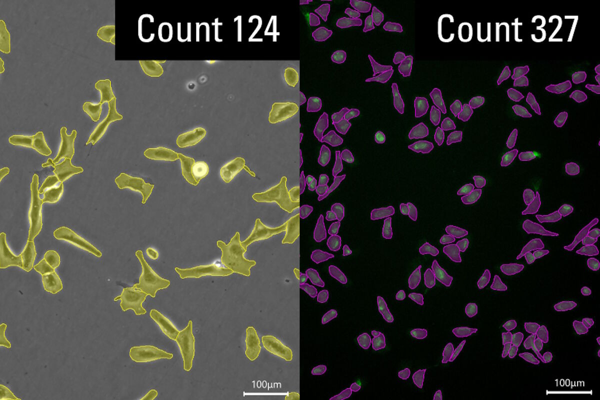 Measuring Cell Fluorescence Using Imagej Two Ways To Count Cells With