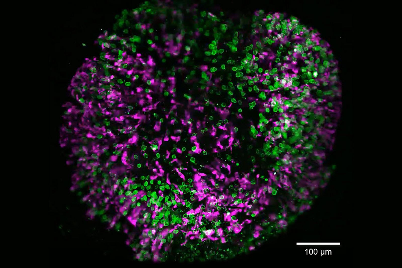 Faster & Deeper Insights into Organoid and Spheroid Models | Learn & Share | Leica Microsystems