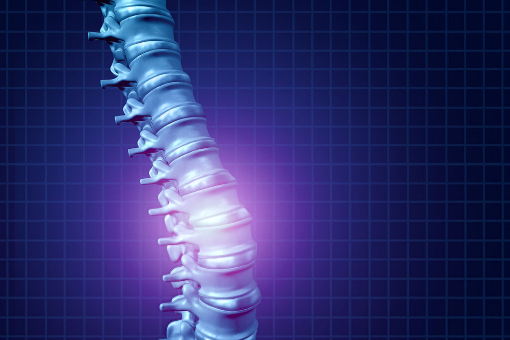 Minimally Invasive Spine Surgery: Improving Precision and Accuracy with ...