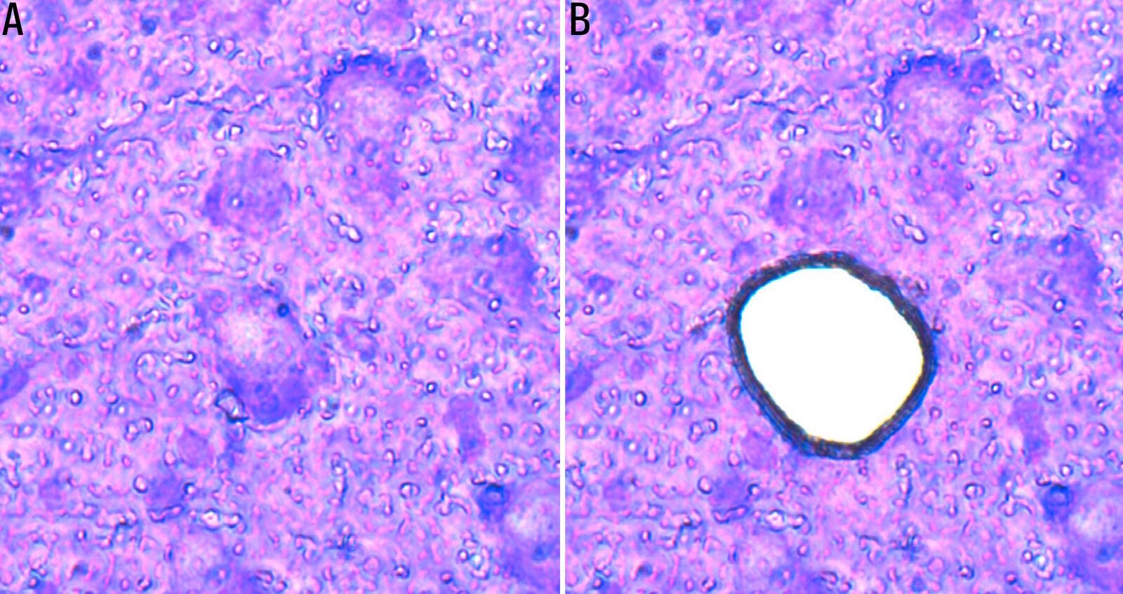 Neuron Isolation in Spatial Context with Laser Microdissection (LMD ...