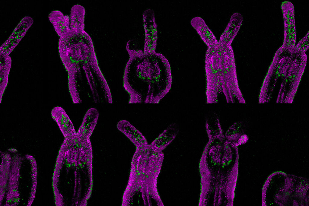 Live Cell Imaging Gallery | Learn & Share | Leica Microsystems