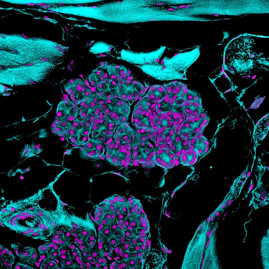 THUNDER Imager Tissue | Products | Leica Microsystems