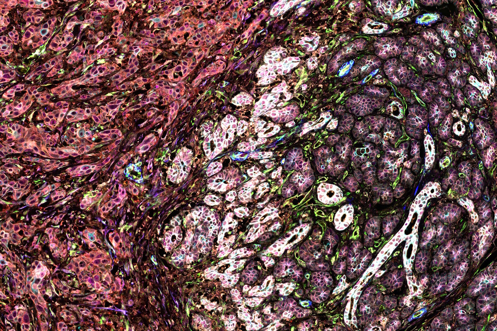 IBEX, Cell DIVE, and RNA-Seq: A Multi-omics Approach to Follicular ...