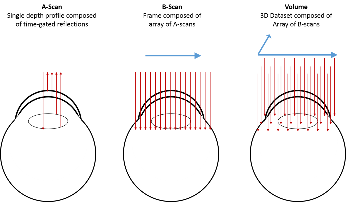 A Guide to OCT | Learn & Share | Leica Microsystems