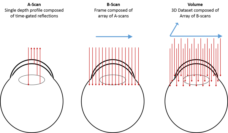 A Guide to OCT | Learn & Share | Leica Microsystems