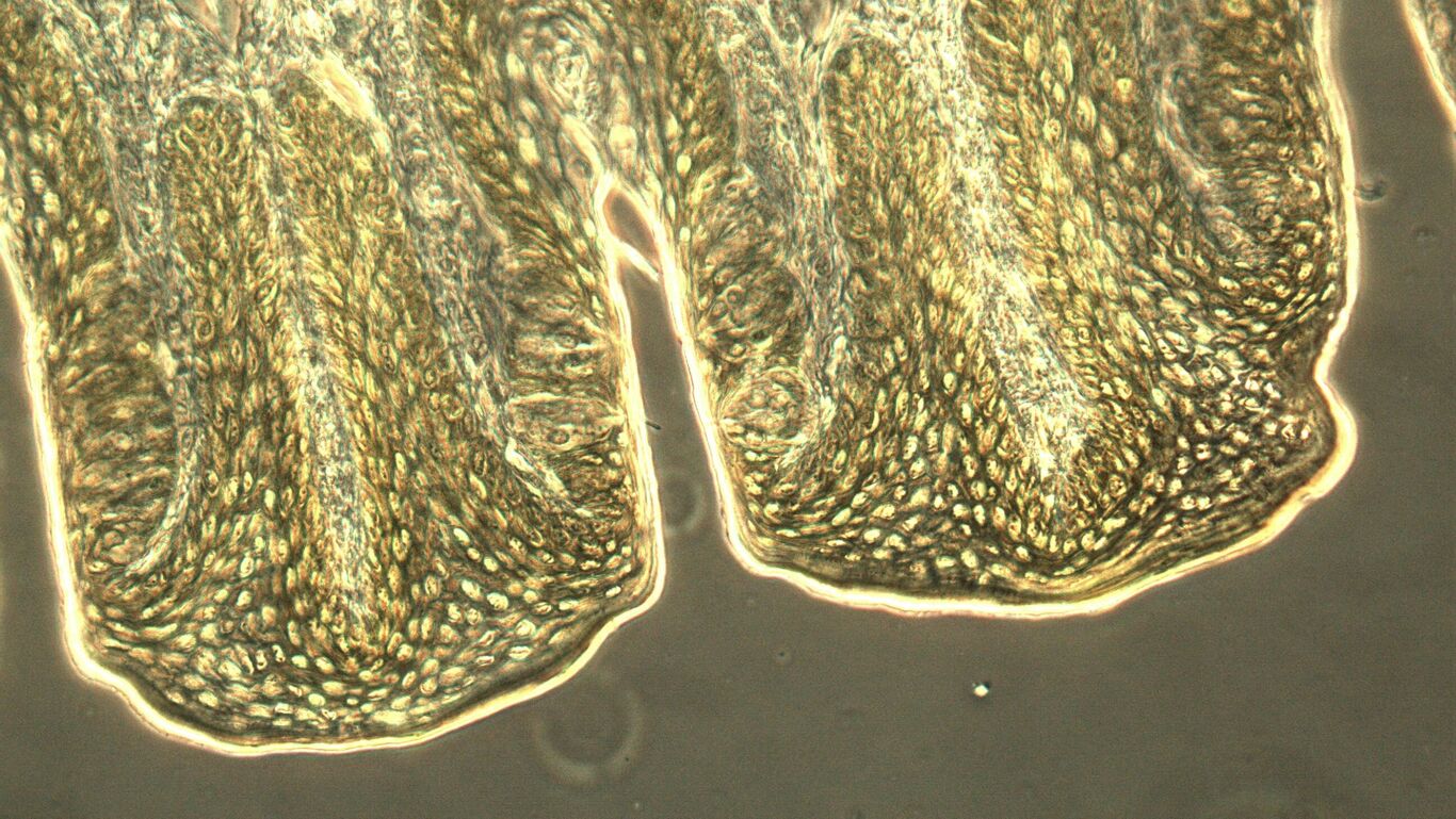 A Guide to Phase Contrast | Learn & Share | Leica Microsystems