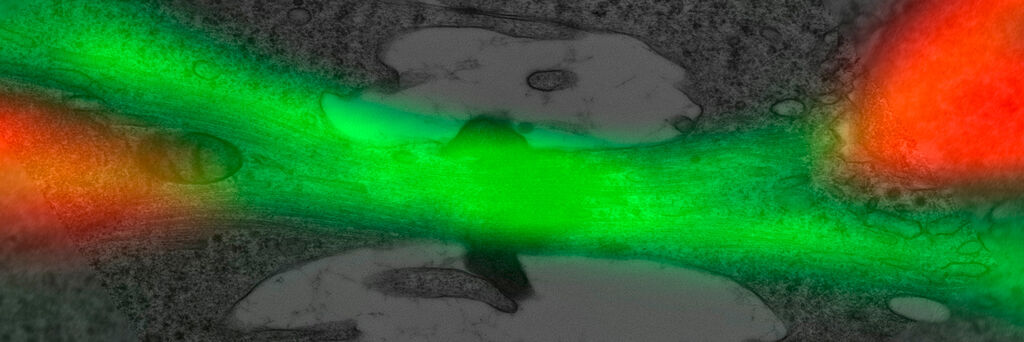 Correlative Light and Electron Microscopy (CLEM) | Applications | Leica ...
