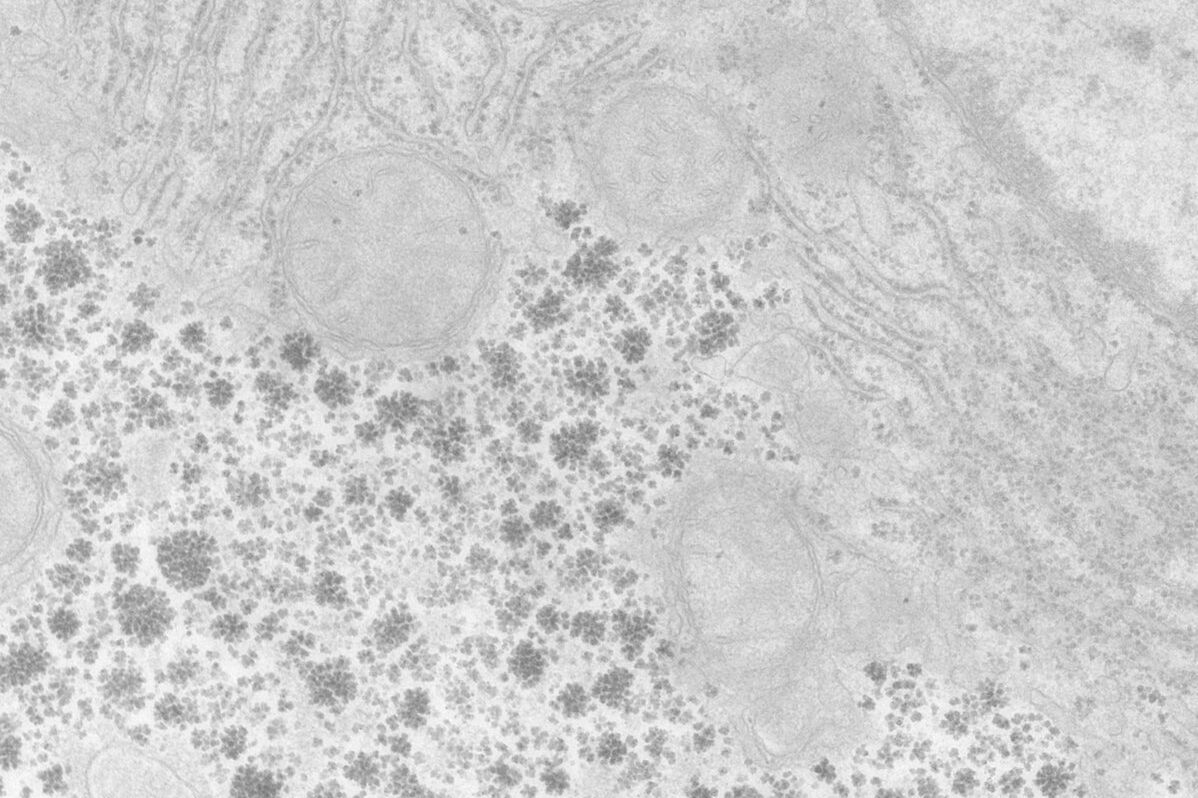 Perusing Alternatives for Automated Staining of TEM Thin Sections ...