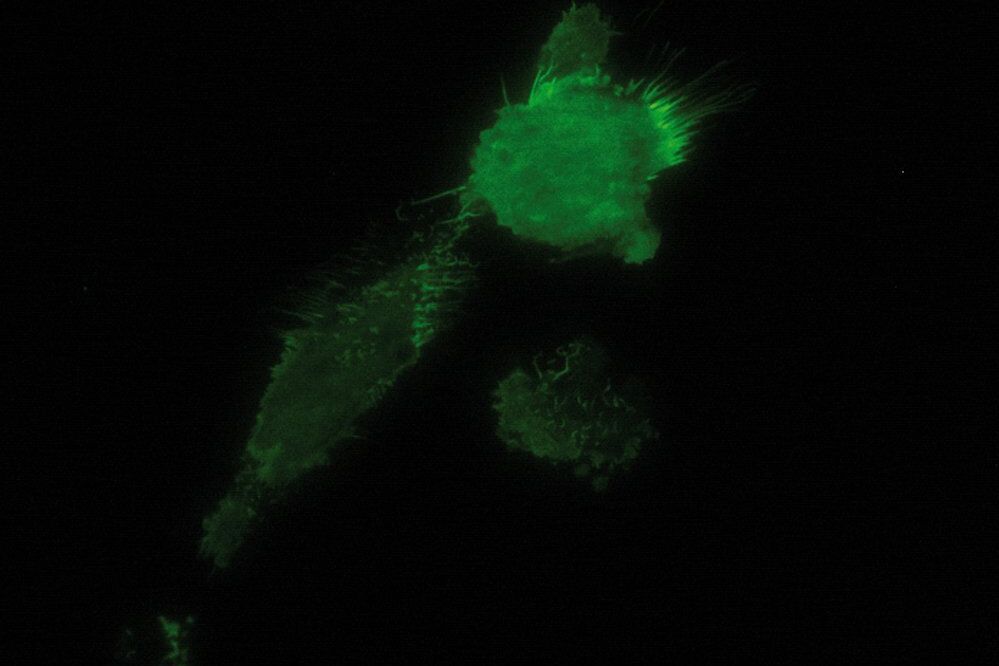 Total Internal Reflection Fluorescence (TIRF) Microscopy | Learn ...