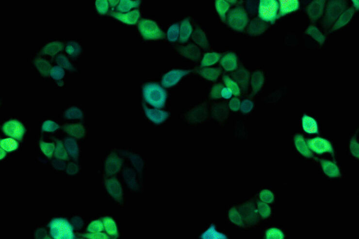 A Guide to Fluorescence Lifetime Imaging Microscopy (FLIM) | Learn ...