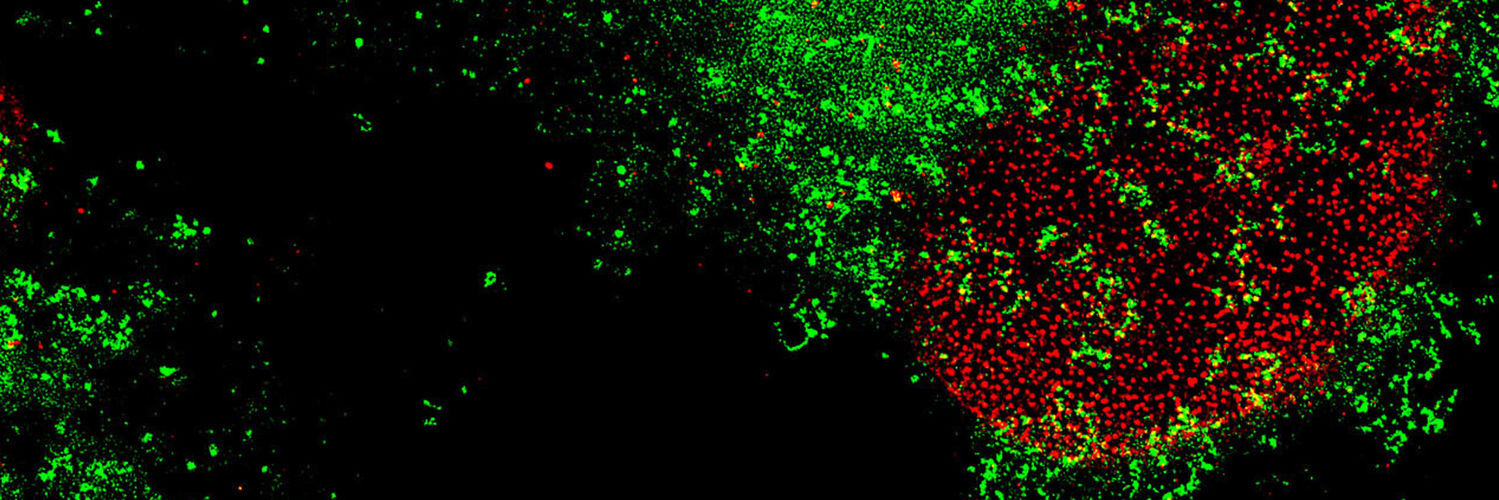 Confocal Microscopes | Products | Leica Microsystems