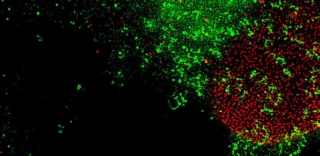 Confocal Microscopes | Products | Leica Microsystems