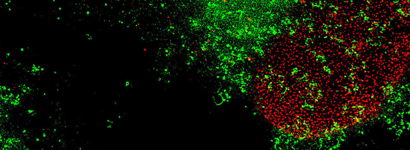 SP8 LIGHTNING Confocal Microscope | Products | Leica Microsystems