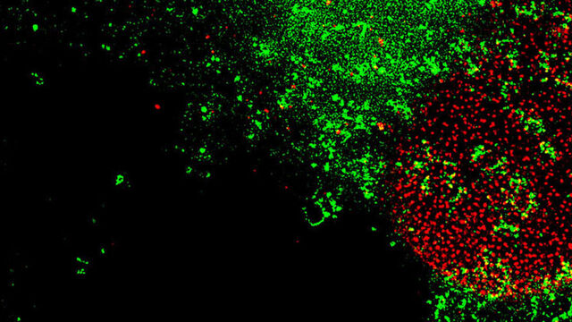 Confocal Microscopes | Products | Leica Microsystems